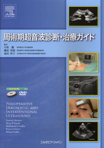 周術期超音波診断・治療ガイド Dominic Harmon／原著 Henry P．Frizelle／原著 NavParkash S ...